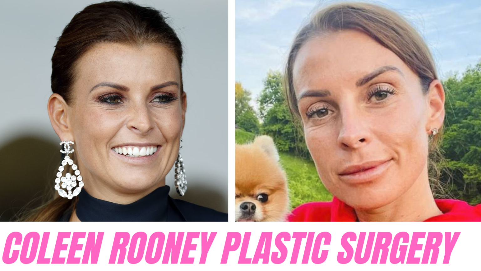 Coleen Rooney Plastic Surgery And Her Weight Loss Journey ...